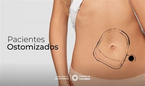 Día Mundial del Paciente Ostomizado Ministerio de Salud Pública de