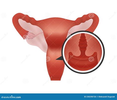 Realistic Female Human Reproductive System On White Background Focus On Cervix Reproductive