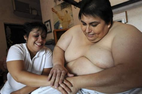 Murió Manuel Uribe el hombre que llegó a ser el más obeso del mundo