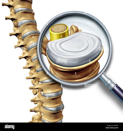 Anatomy Of Lumbar Spine High Resolution Stock Photography And Images