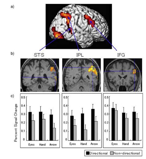 A Statistical Parametric Maps Indicating The Brain Regions That Were