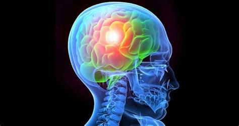 Lesión traumática de cerebro puede traer consecuencias casi 20 años más