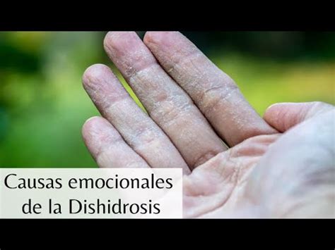 Descubre Los Mejores Remedios Caseros Para Combatir La Piel Seca Se Me