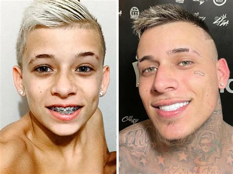 Antes e depois de MC Pedrinho viraliza veja as mudanças