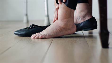 Las Causas Ocultas De Los Pies Hinchados Nexofin