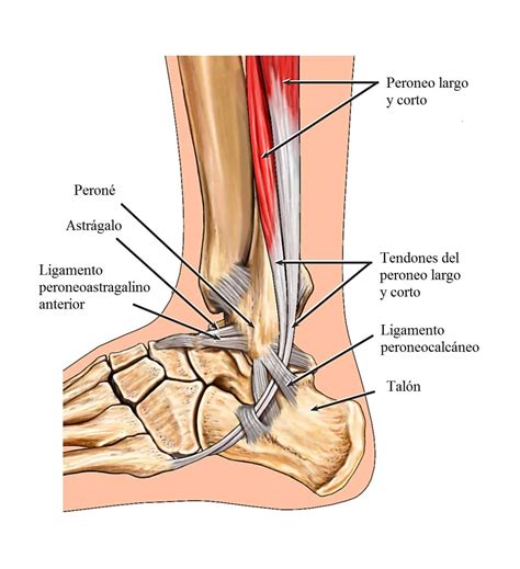 Sedante Acento Margen Plantillas Para Tendinitis Peroneos C Lculo