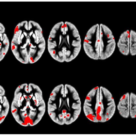 design of the fmri task with the encoding left and retrieval right download scientific