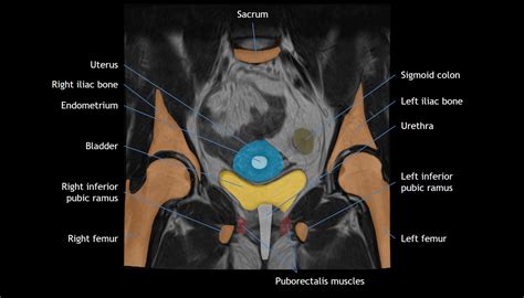 Pelvis Anatomy Module Casestacks