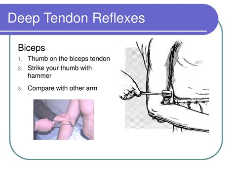 Deep Tendon Reflexes Upper Extremity