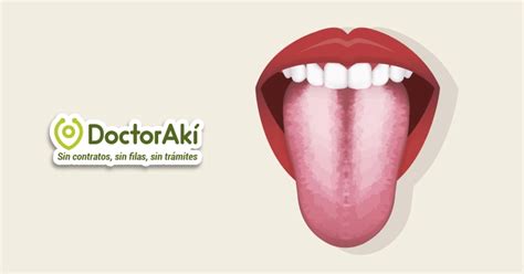 Lengua blanca qué es signos y causas DoctorAkí