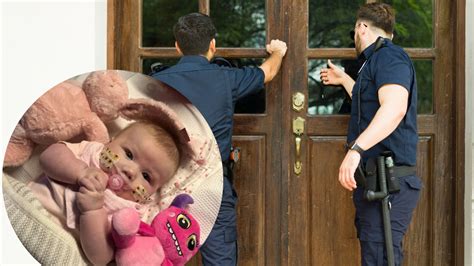 Mama zauważyła na ciele córeczki siniaki Lekarz zgłosił że kobieta