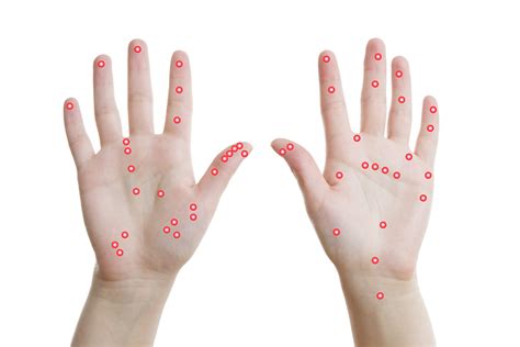 Les points d acupressure pour diminuer le stress et l anxiété