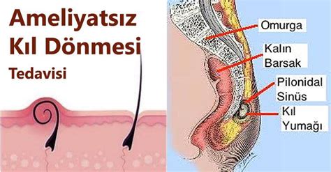 Uygunsuz farklı Postempresyonizm kil donmesi nasil olur Alçı Cilalı Aksan
