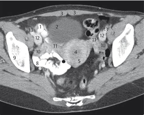 Female Pelvis Radiology Key