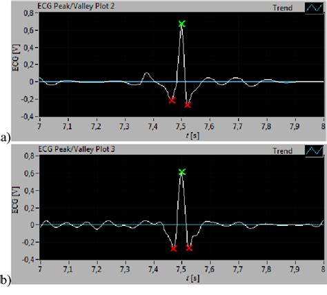 figure 4 from qrs time detection using wavelet multiresolution analysis for determining hrv in