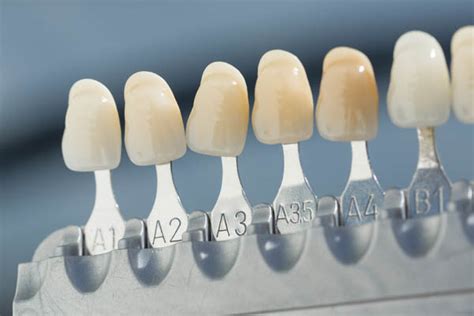 Dental Veneers To Fix A Gap Between Teeth Hemet Dental Center Brian