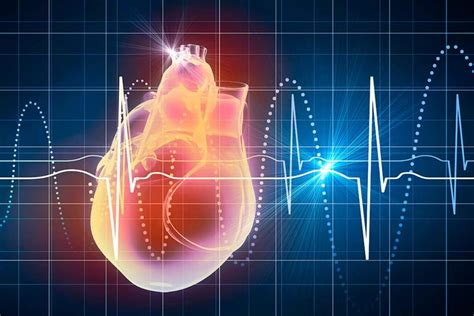 Infarto agudo al miocardio causas síntomas y tratamietno La Guía de