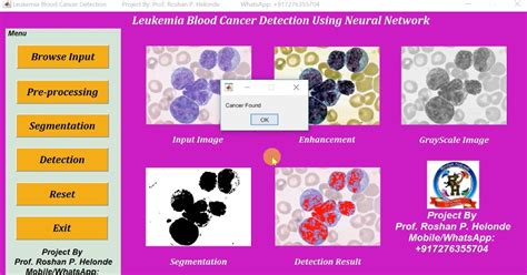 Blood Cancer Detection Using Neural Network Matlab Project Source