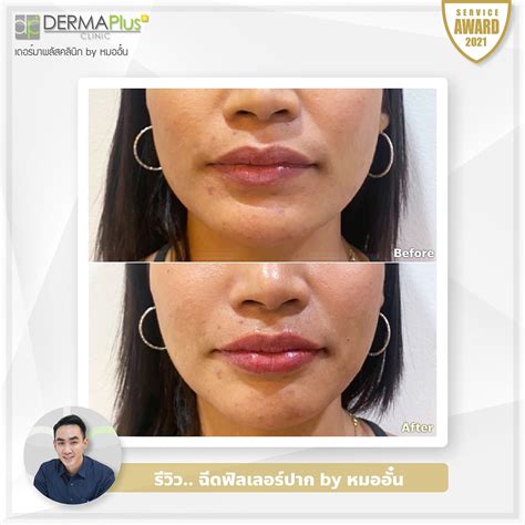 Review Lips Dermaplus Clinic Phuket By