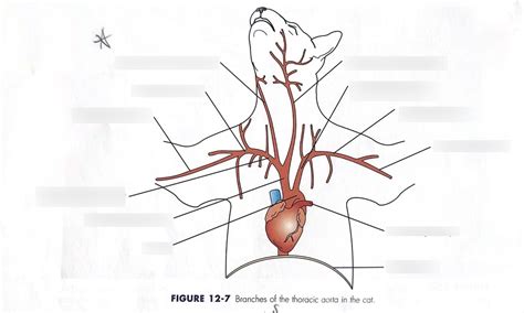 Branches Of The Thoracic Aorta Diagram Quizlet