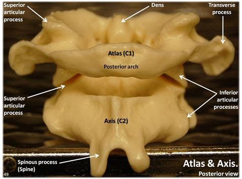 Vertebra Axis And Atlas