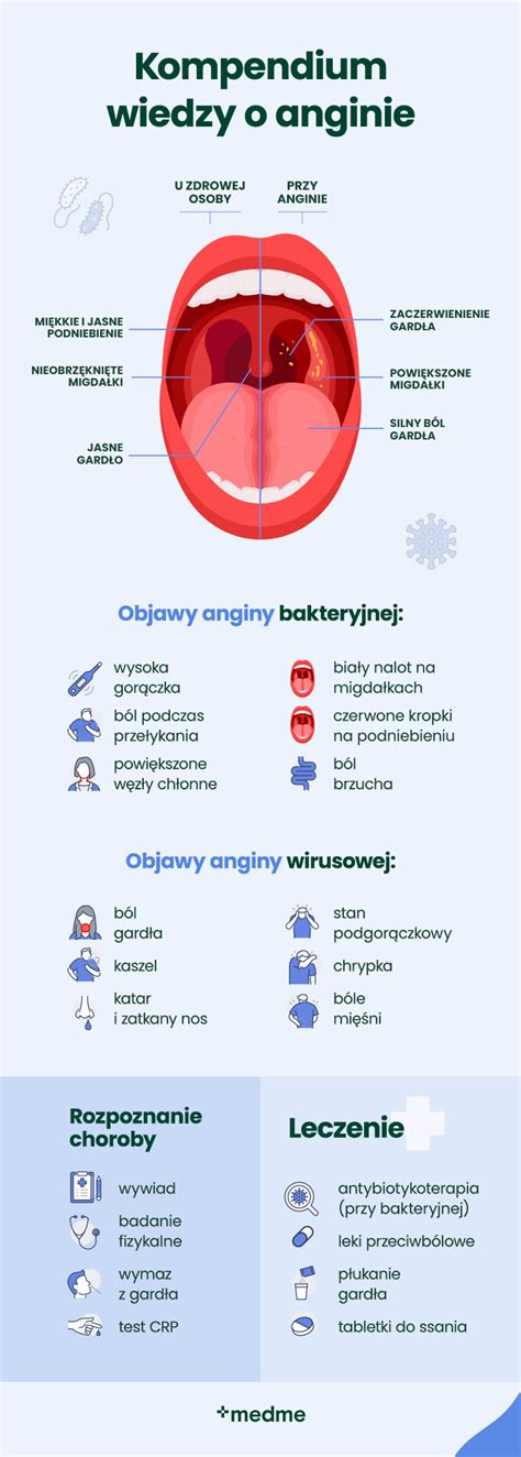 Angina Przyczyny Objawy I Leczenie Czy Jest Zara Liwa