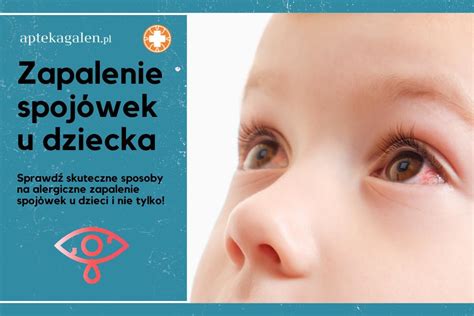 Zapalenie Spoj Wek U Dziecka Objawy Przyczyny Leczenie