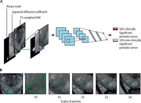 an integrated nomogram combining deep learning prostate imaging reporting and data system pi