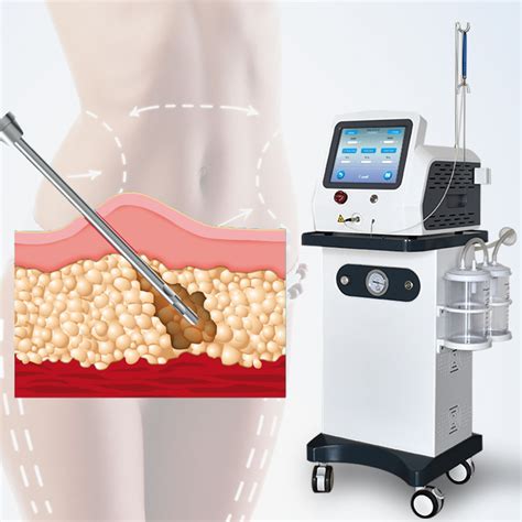 980 1470nm Diode Laser Machine Liposuction Laser Machine 980Class IV