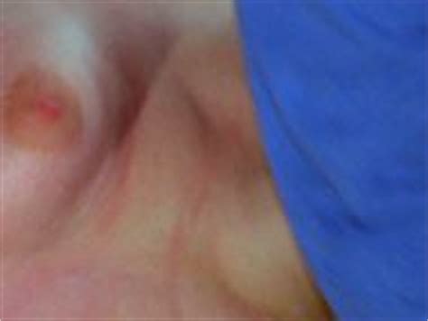 Joyce Van Patten Nue Dans Bone