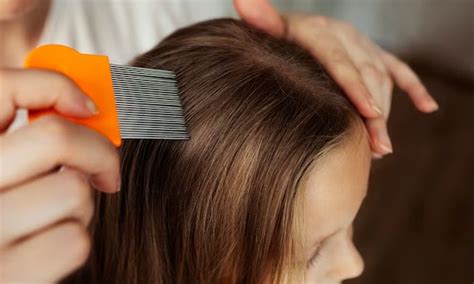 Pediculosis Piojos En La Cabeza Lo Que Los Padres Deben Saber