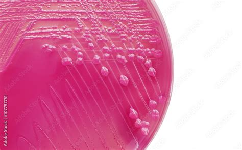 E Coli Bacterial Colonies On MacConkey Agar Plate Stock Photo Adobe Stock