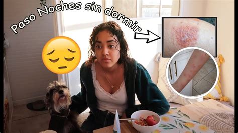 Esto le Pasó a Naomi pero ya está Mejor Gracias a Dios YouTube