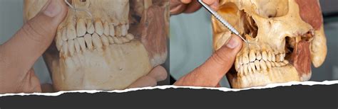 Qué Es La Odontología Forense Dental Para Cual