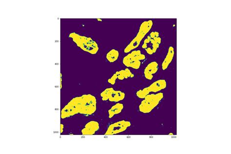 opencv how can i improve watershed segmentation of heterogenous structures in python stack