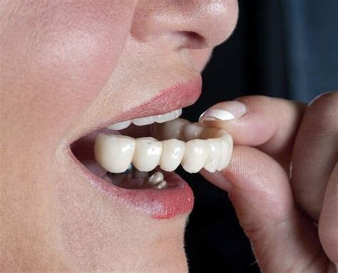 Prótese Total Removível A D Odontologia
