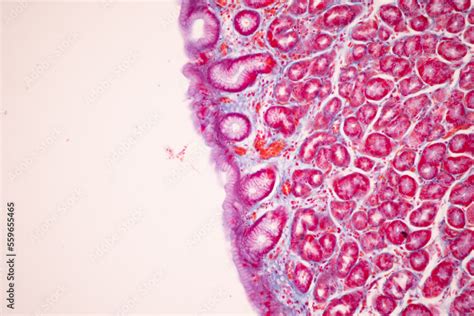 Tissue Of Small Intestine Duodenum Large Intestine Human And Stomach