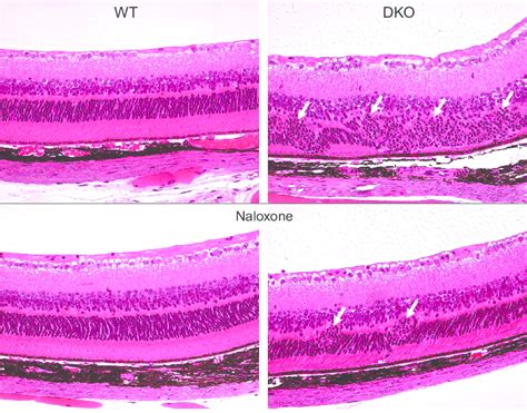 Photomicrographs Of Mouse Retina Normal Retinal Structure Was