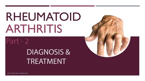 Diagnosis Treatment Of Rheumatoid Arthritis Rheumatoid Arthritis