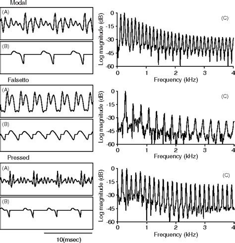 figure 4 from analysis of voice source characteristics using a constrained polynomial model