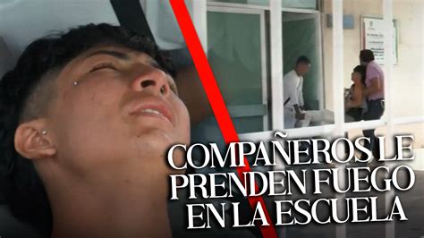 Compañeros le prenden fuego a un joven en la escuela tiene quemaduras