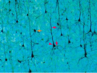 Cerebral Cortex Neupsy Key