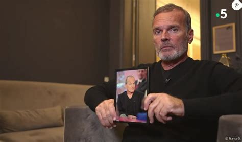 Laurent Baffie Se Confie Sur La Torture Des Implants Capillaires