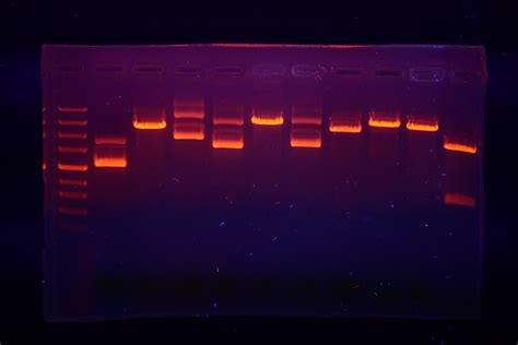 How Does Gel Electrophoresis Separate DNA Fragments Pediaa
