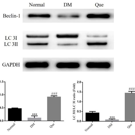 Col Iv E Cadherin Sma And Snail Mrna Expression By Wb Assay