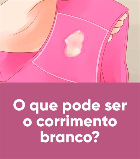 Corrimento Branco É normal O que Pode ser Corrimento branco
