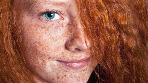 Eliminar manchas de la cara descubre los mejores tratamientos y cuándo
