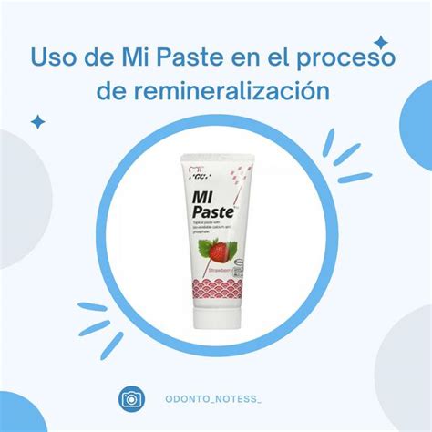 Uso de Mi Paste en el proceso de remineralización Elizabeth Salazar