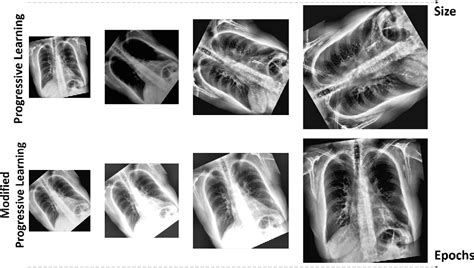 Figure From Multi Head Deep Learning Framework For Pulmonary Disease
