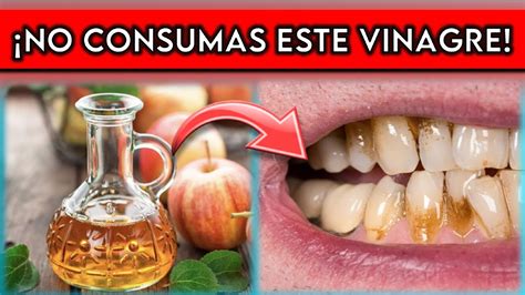 NO DEBES HACER ESTO Si Tomas VINAGRE DE MANZANA NO Consumas VINAGRE